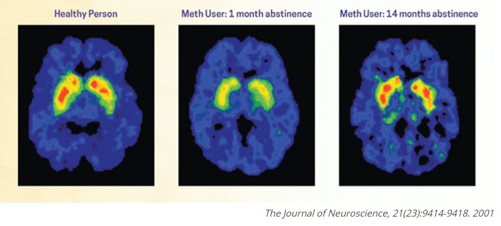 healed brain | We Chose Love